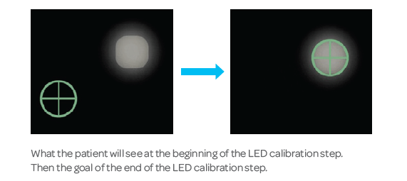 How to Perform a Dark Adaptation Test